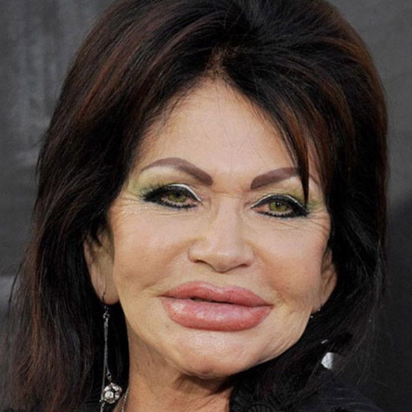 Le dieci persone più brutte del mondo a causa della chirurgia estetica